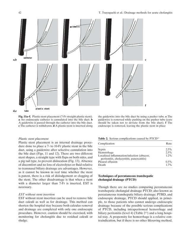 Tokyo guidelines for cholangitis and cholecystitis | PDF | Surgery ...