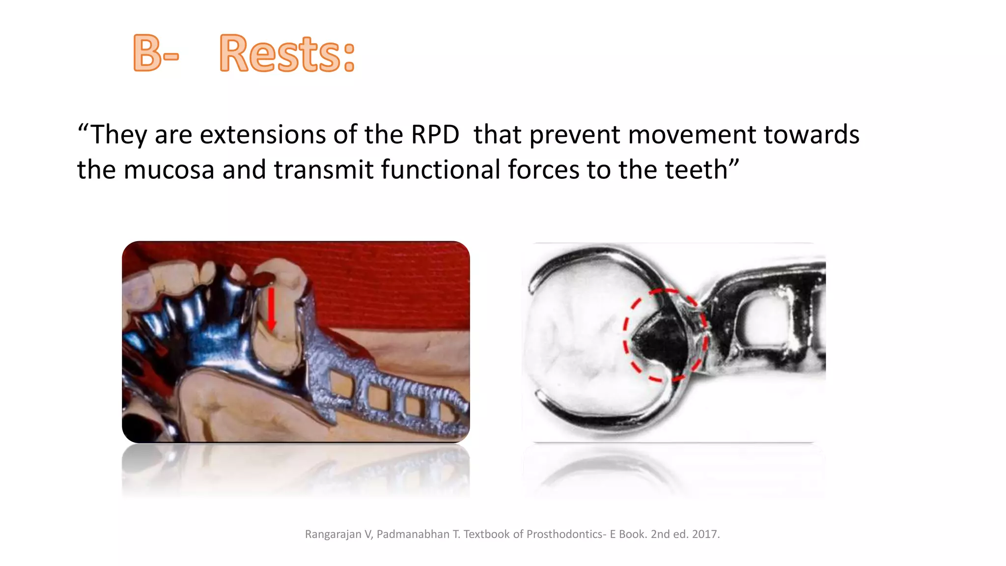 Materials used in RPD construction | PDF