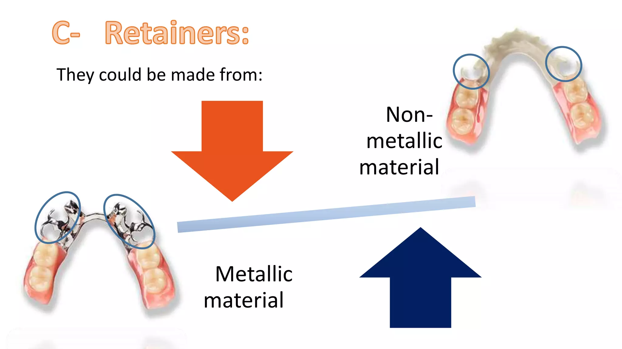 Materials used in RPD construction | PDF