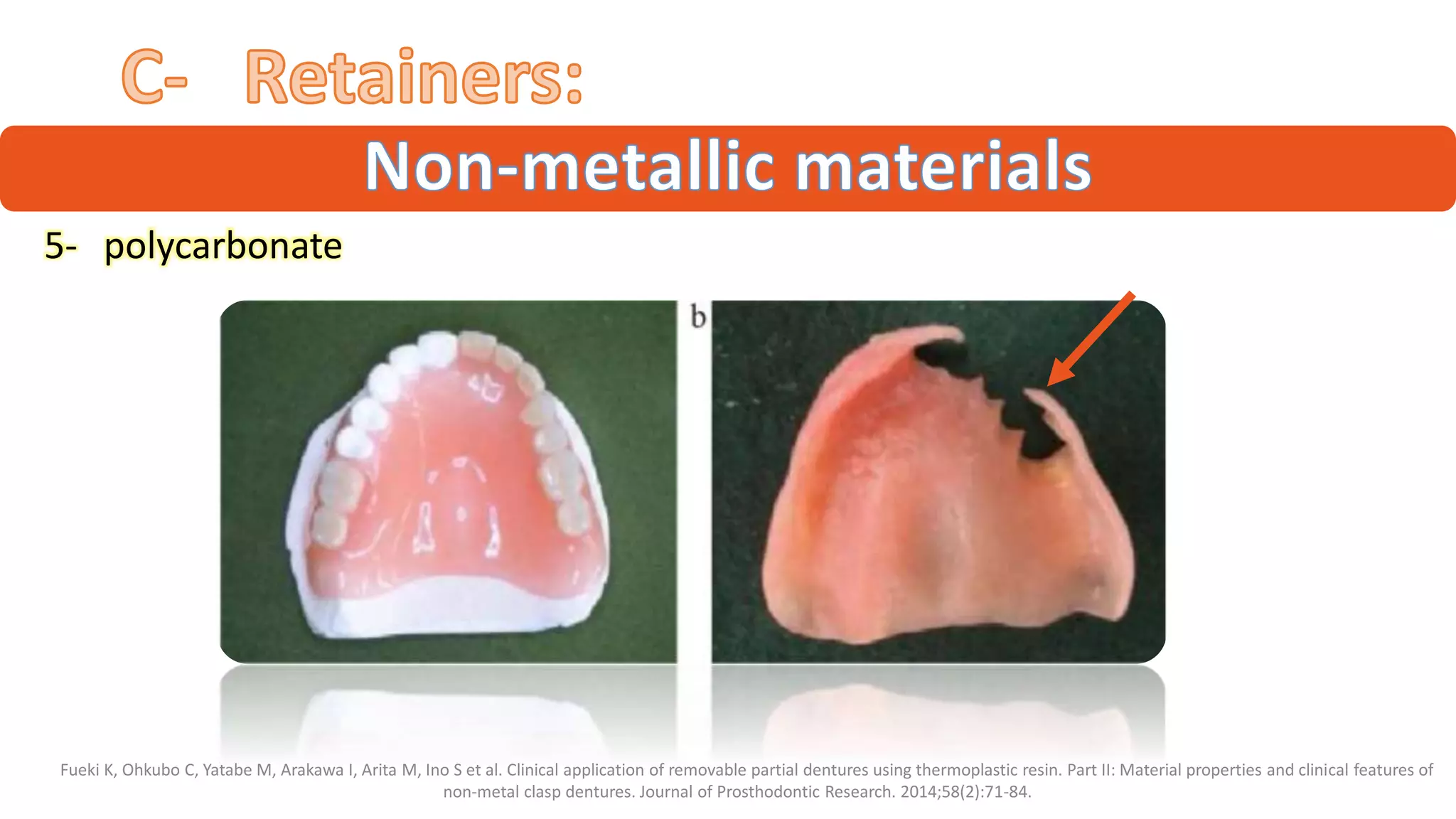 Materials used in RPD construction | PDF