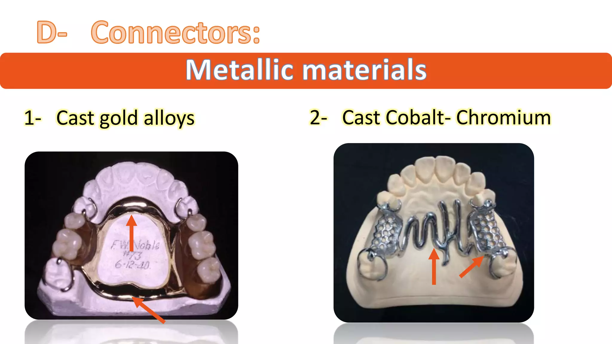 Materials used in RPD construction | PDF