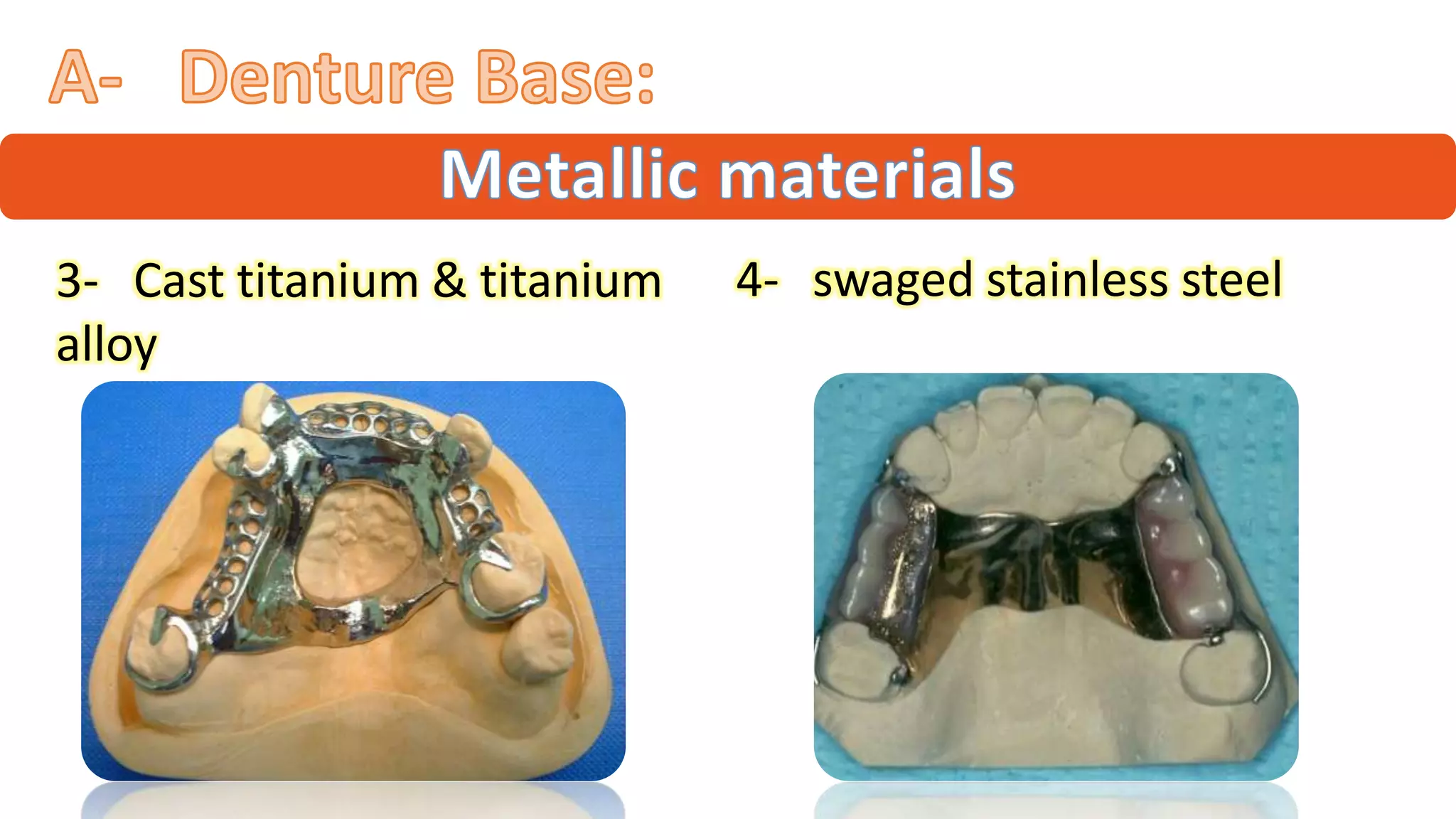 Materials used in RPD construction | PDF