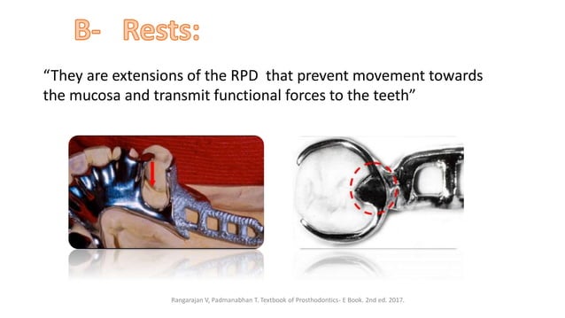 Materials used in RPD construction | PDF | Dental Health | Diseases and ...