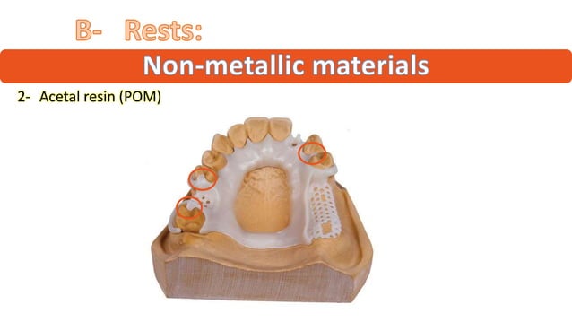 Materials used in RPD construction | PDF | Dental Health | Diseases and ...