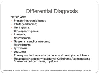 Tolosa Hunt Syndrome | PPTX