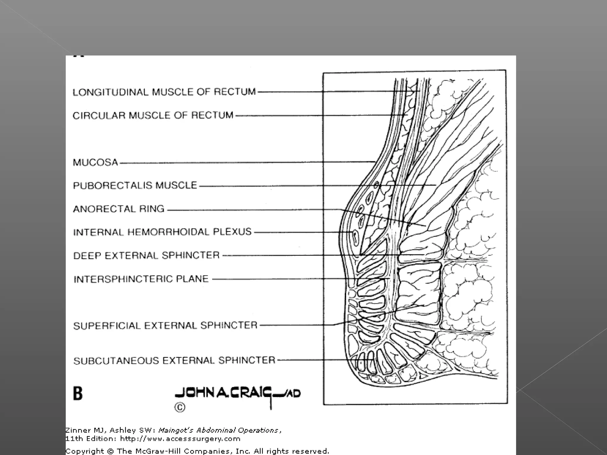 Ca recti Miles operation Abdominalperinealresection | PPT