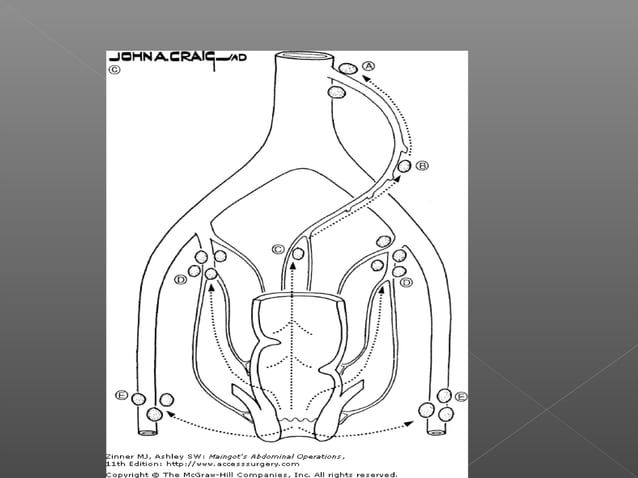 Ca recti Miles operation Abdominalperinealresection