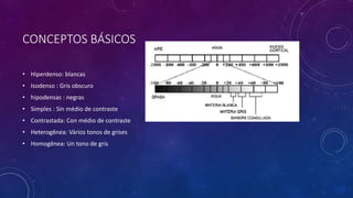 Tomografía computarizada | PPTX