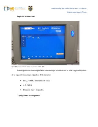 Técnica de Tomografía computarizada.docx