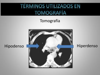 Tomografia | PPTX