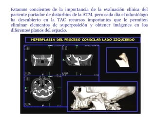 Tomografia Computarizada | PPS