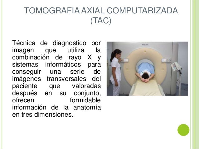 Tomografia axial computarizada (TAC), TOMOGRAFIA COMPUTARIZADA HELICO…