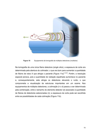 Tomografia computadorizada tecnologia_e_funcionamento_equipamentos | PDF