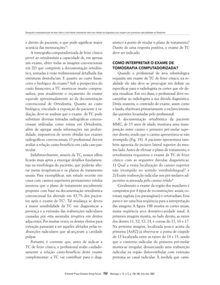 Tomografia feixe conico | PDF