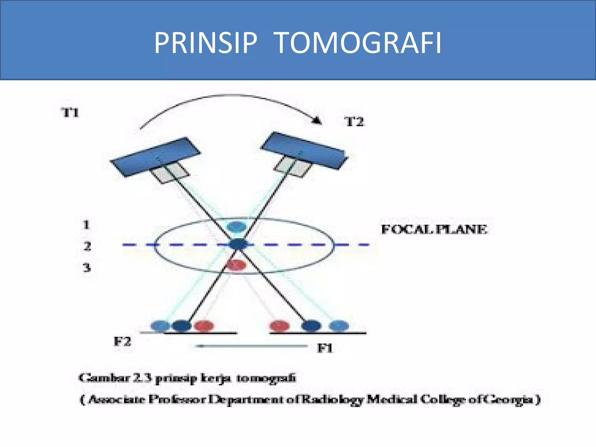 Teknik Radiografi 2 Tomografi | PPT