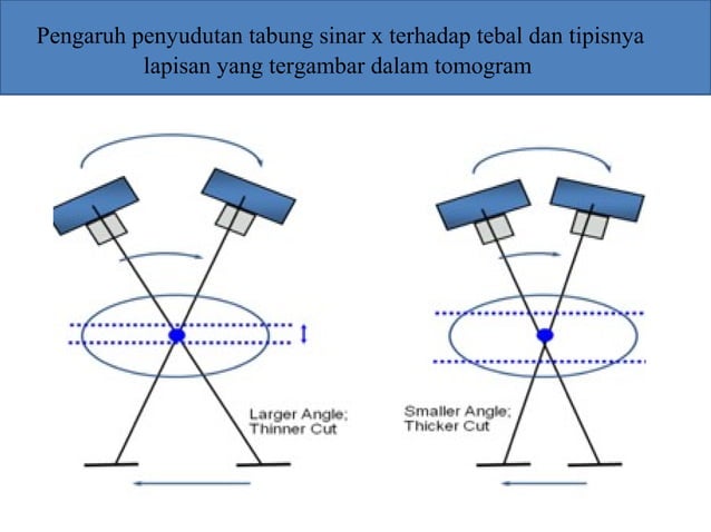 Teknik Radiografi 2 Tomografi | PPT