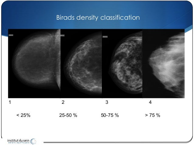 Luc Rotenberg, Tomosynthese et densité mammaire 2015