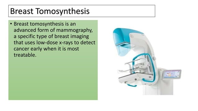 TOMOSYNTHESIS.pptx