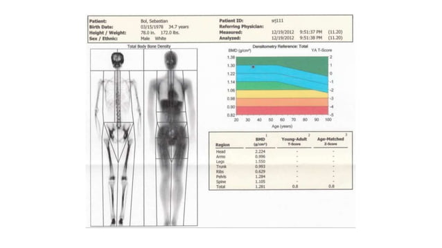 Tomosynthesis & Dexa Scan (BMD)- Its Application & Techniques | PPTX ...