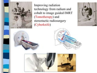 Tomotherapy | PPT