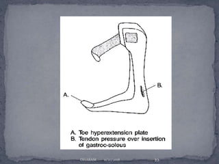 Tone reducing orthosis | PPTX