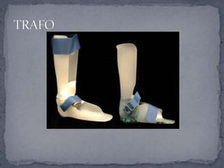 Tone reducing orthosis | PPTX