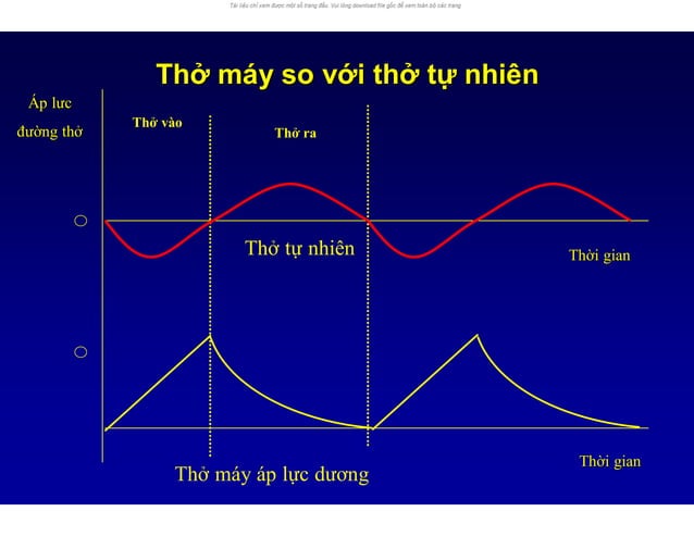 tổng quan về thở máy (thông khí cơ học) | PPT