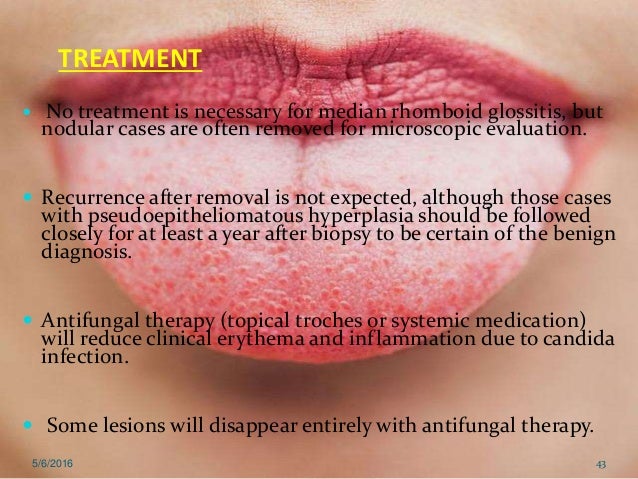 Thyroid Symptoms Tongue