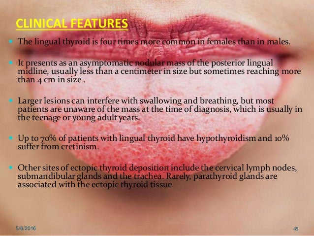Thyroid Symptoms Tongue