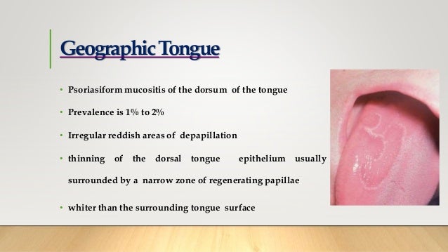The tongue, its development and anatomy