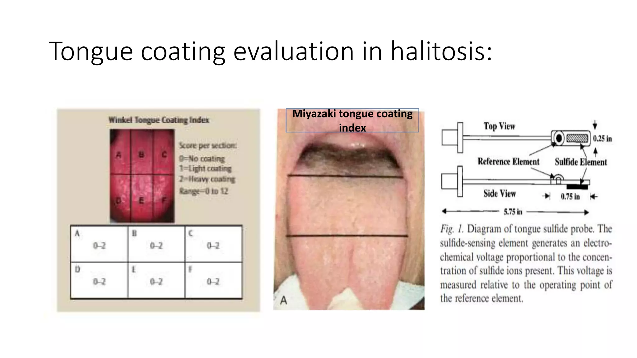 Tongue | PPTX