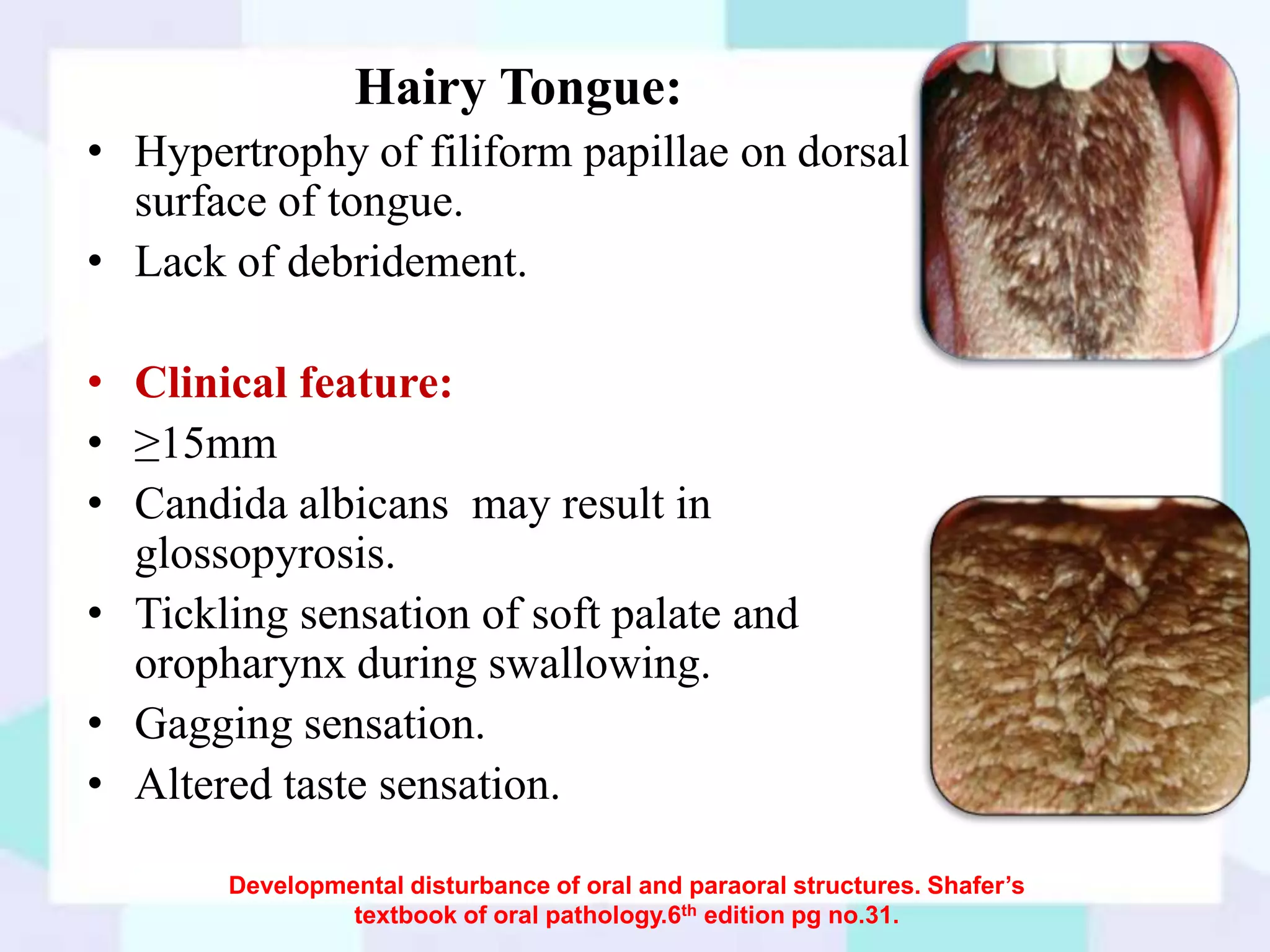 Tongue | PPTX