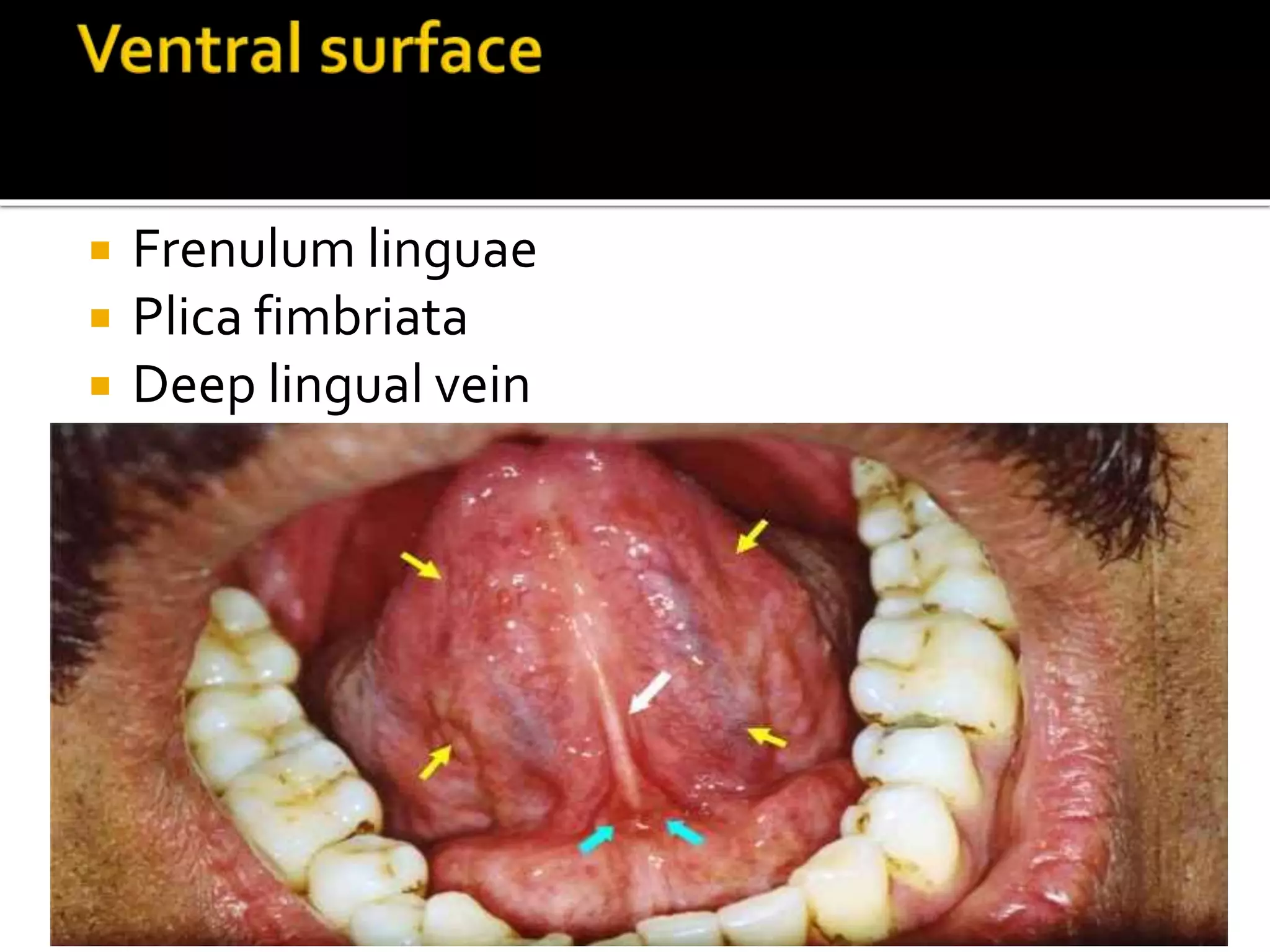 Anatomy of Tongue | PPTX | Ear, Nose and Throat Conditions | Diseases ...