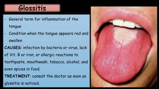 Tongue | PPT