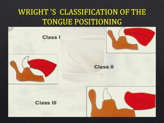 Tongue | PPT