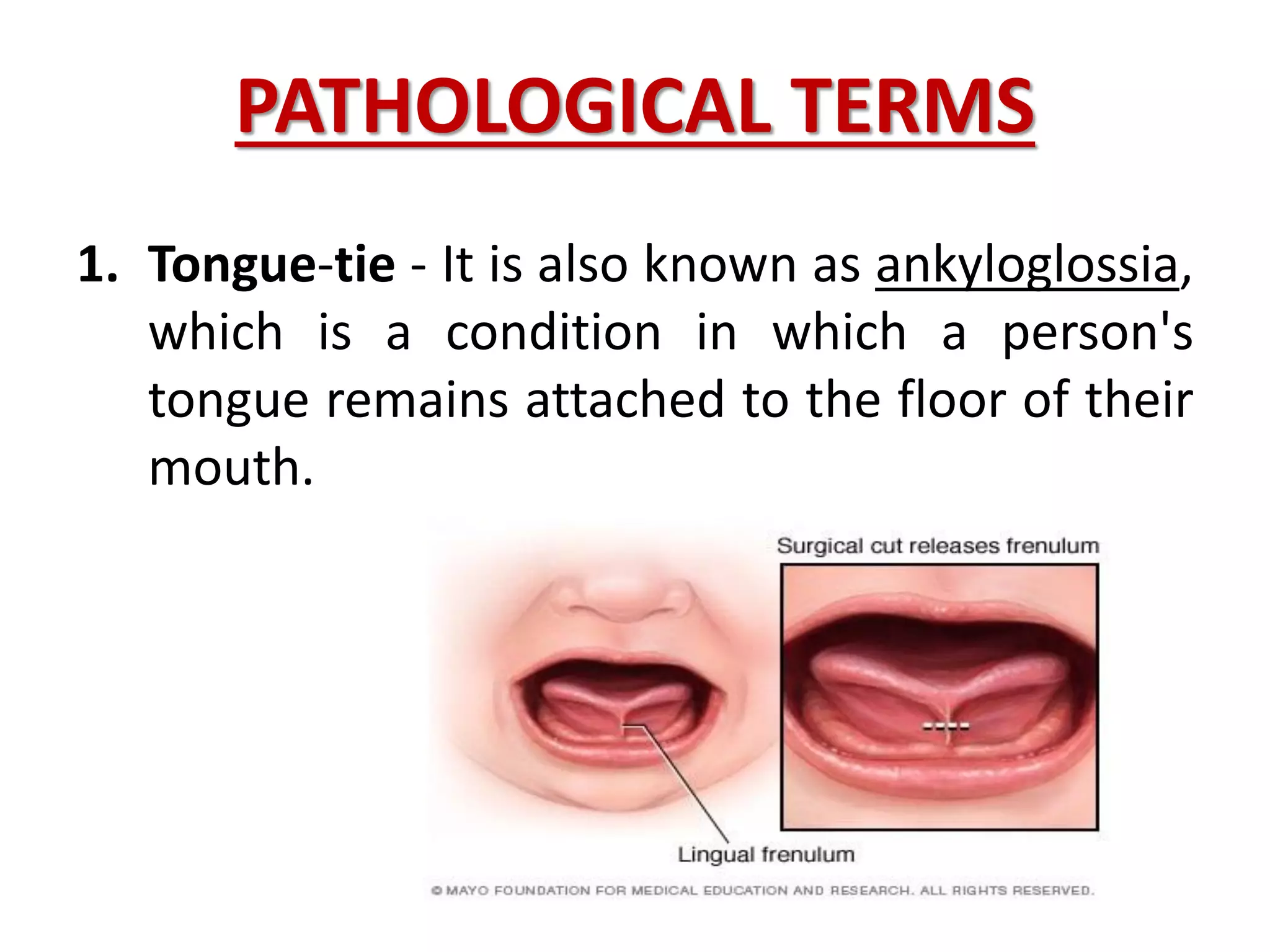 TONGUE.pdf