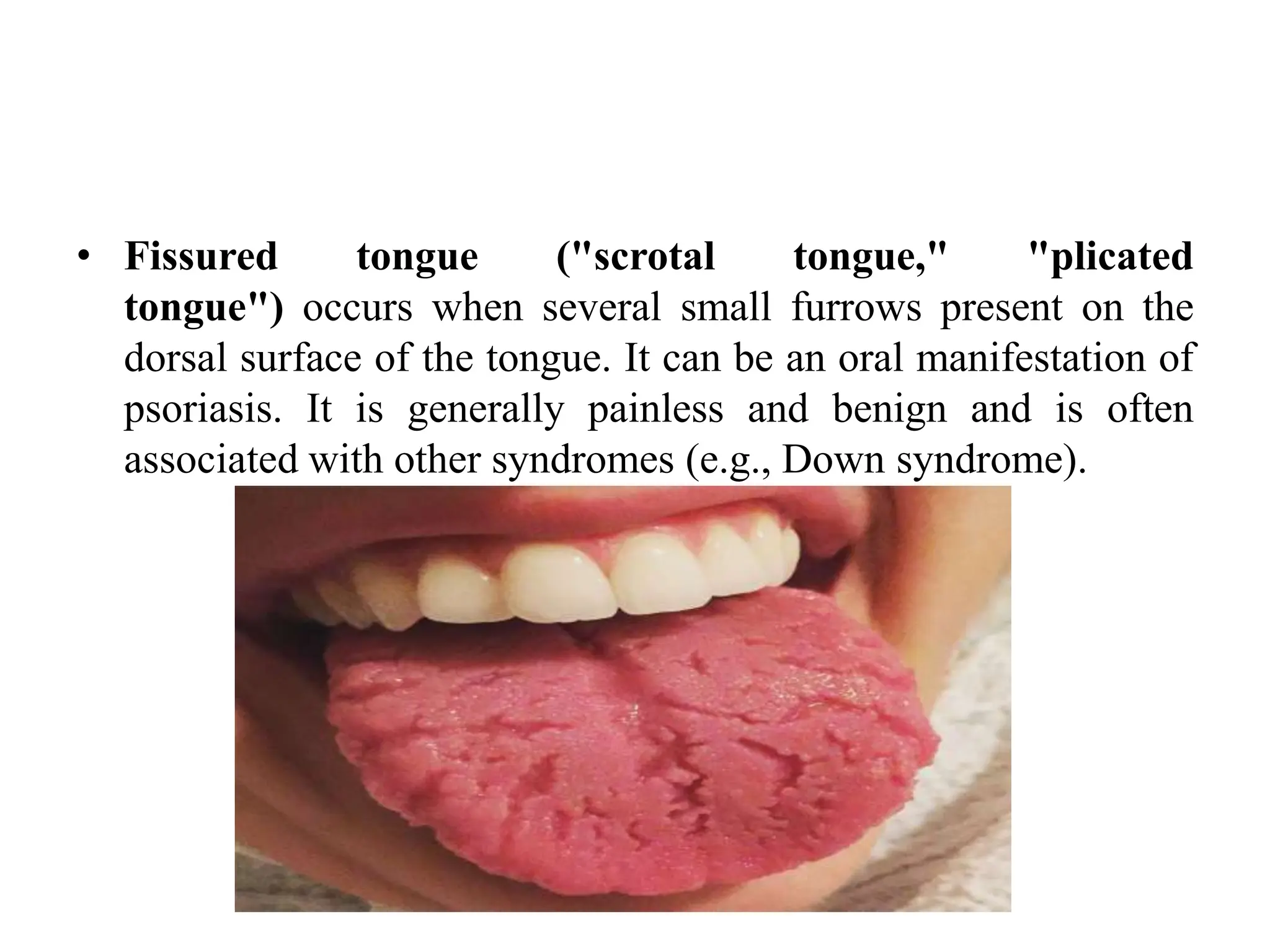 Brief Details of Tongues functions and nerve supply | PPTX