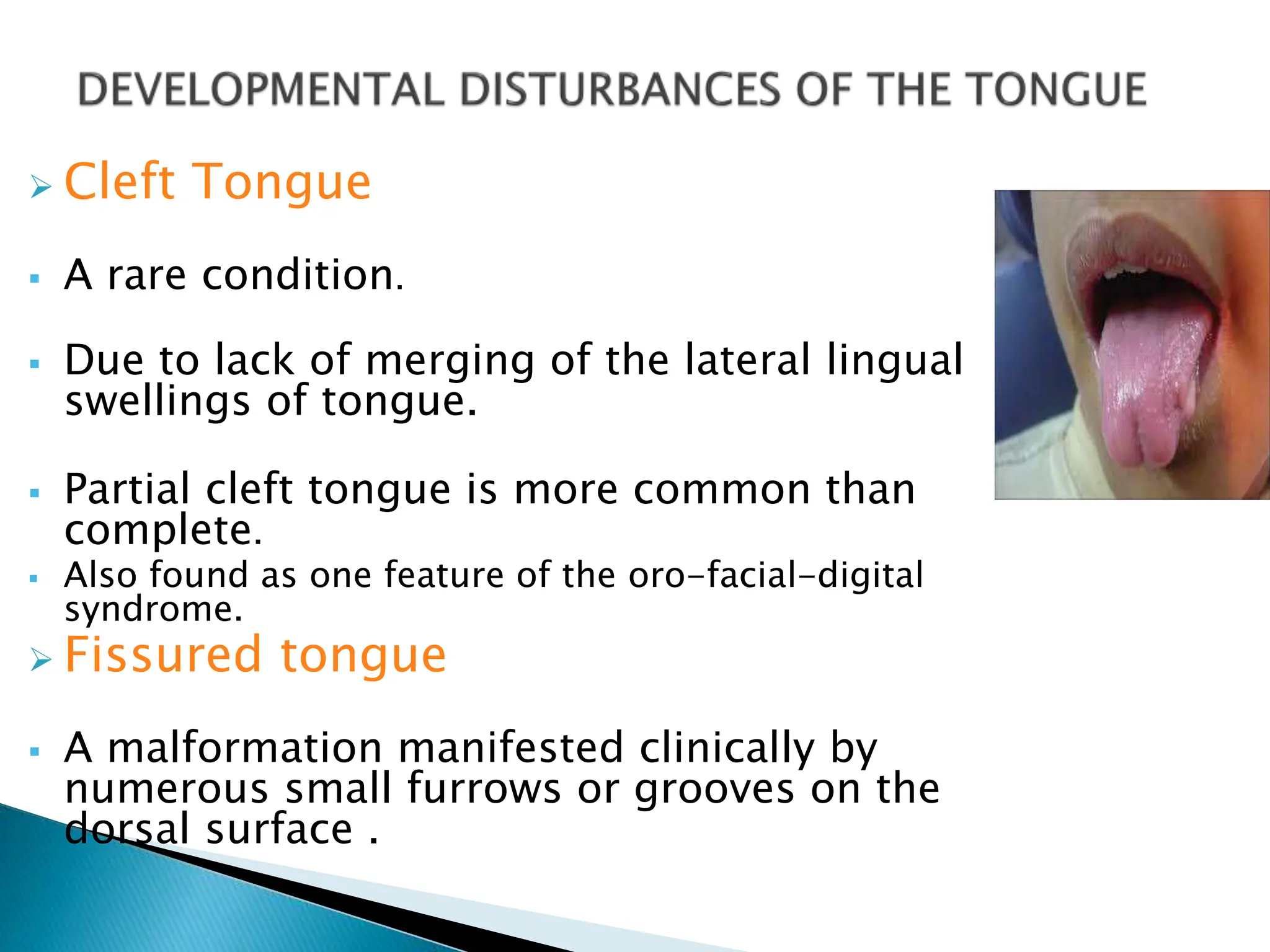 tongue.pptx oral and maxillofacial pathology basic | PPTX | Ear, Nose ...