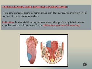 tongue and its prosthodontic considerations | PPTX