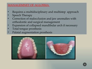 TONGUE ITS ANATOMY DEVELOPMENTAL ANOMALIES AND PROSTHODONTIC ...