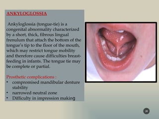 TONGUE ITS ANATOMY DEVELOPMENTAL ANOMALIES AND PROSTHODONTIC ...