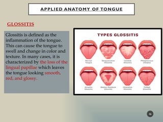 TONGUE ITS ANATOMY DEVELOPMENTAL ANOMALIES AND PROSTHODONTIC ...
