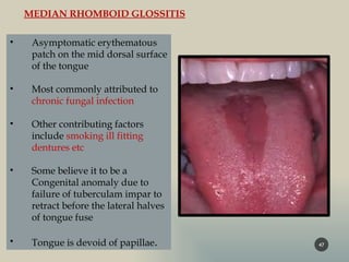 TONGUE ITS ANATOMY DEVELOPMENTAL ANOMALIES AND PROSTHODONTIC ...