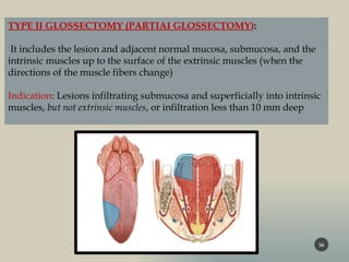 TONGUE ITS ANATOMY DEVELOPMENTAL ANOMALIES AND PROSTHODONTIC ...
