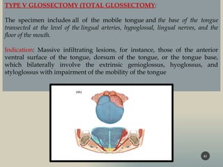TONGUE ITS ANATOMY DEVELOPMENTAL ANOMALIES AND PROSTHODONTIC ...