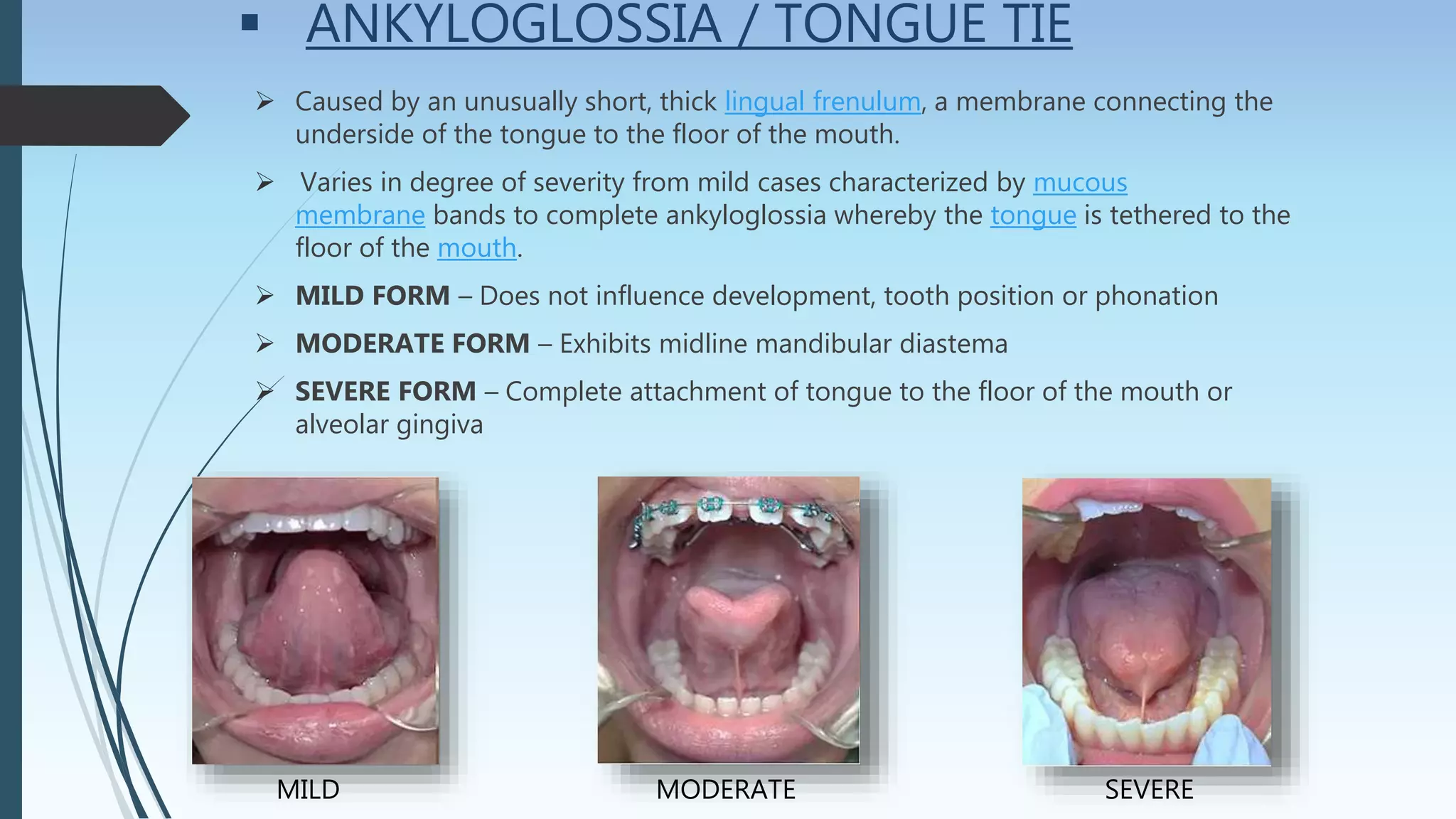 Tongue | PPTX