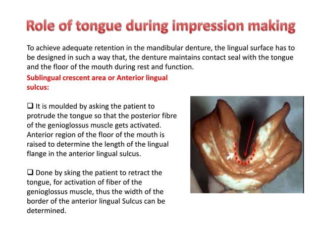 Tongue development,anatomy,prosthetic consideration | PPTX | Ear, Nose ...