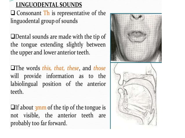 Tongue development,anatomy,prosthetic consideration | PPTX | Ear, Nose ...