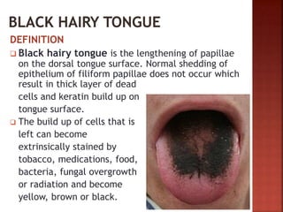 TONGUE-DISORDERS.pptx