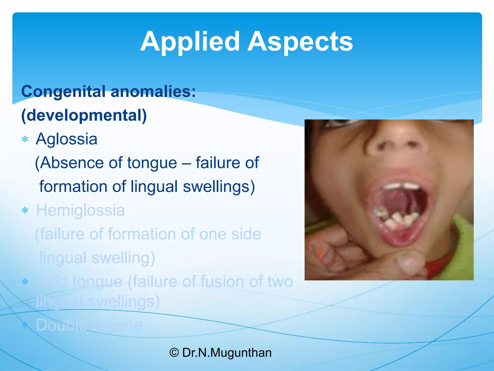 Tongue-Gross Anatomy & Applied Aspects. Dr.N.Mugunthan.M.S | PDF
